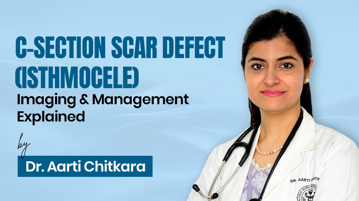 C-Section Scar Defect (Isthmocele): Imaging & Management Explained by ...