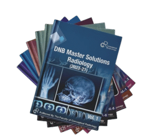 LMA Types Explained for PDCET & DNB Exams: First vs Second Generation ...